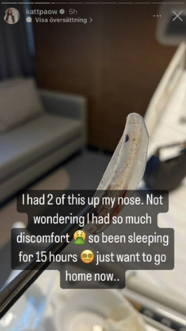 Paow visar upp chockbilder från operationen: "Hade dessa i kroppen..."