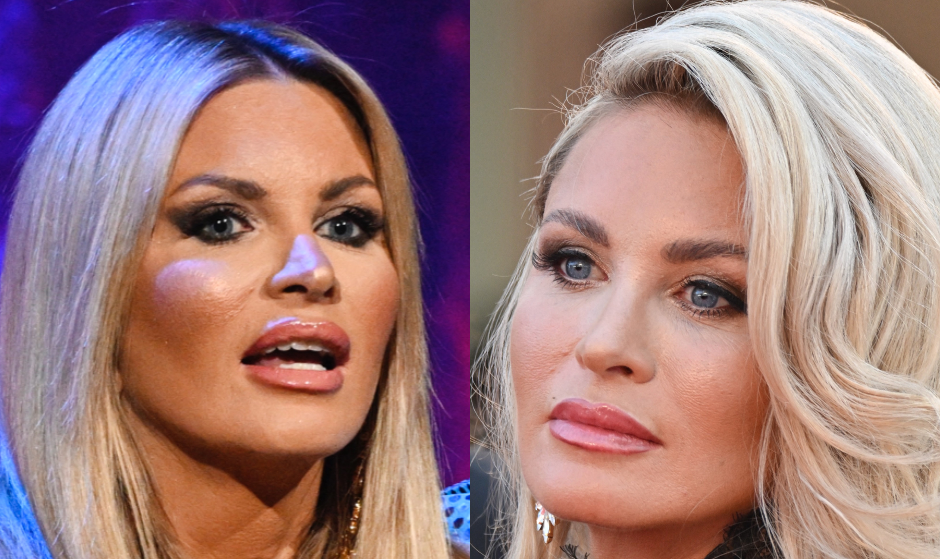 Carolina Gynning avslöjar kroppsproblemet: “Jag kommer berätta…”