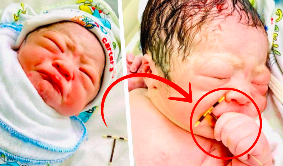 Bilden på nyfödda bebisen har blivit världsberömd – ser du varför?