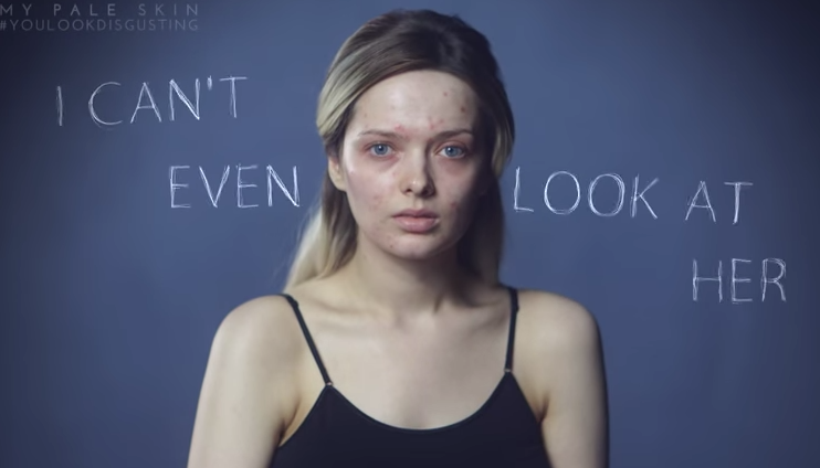 Utseende - Nyheter, artiklar, reportage och video - Nyheter24